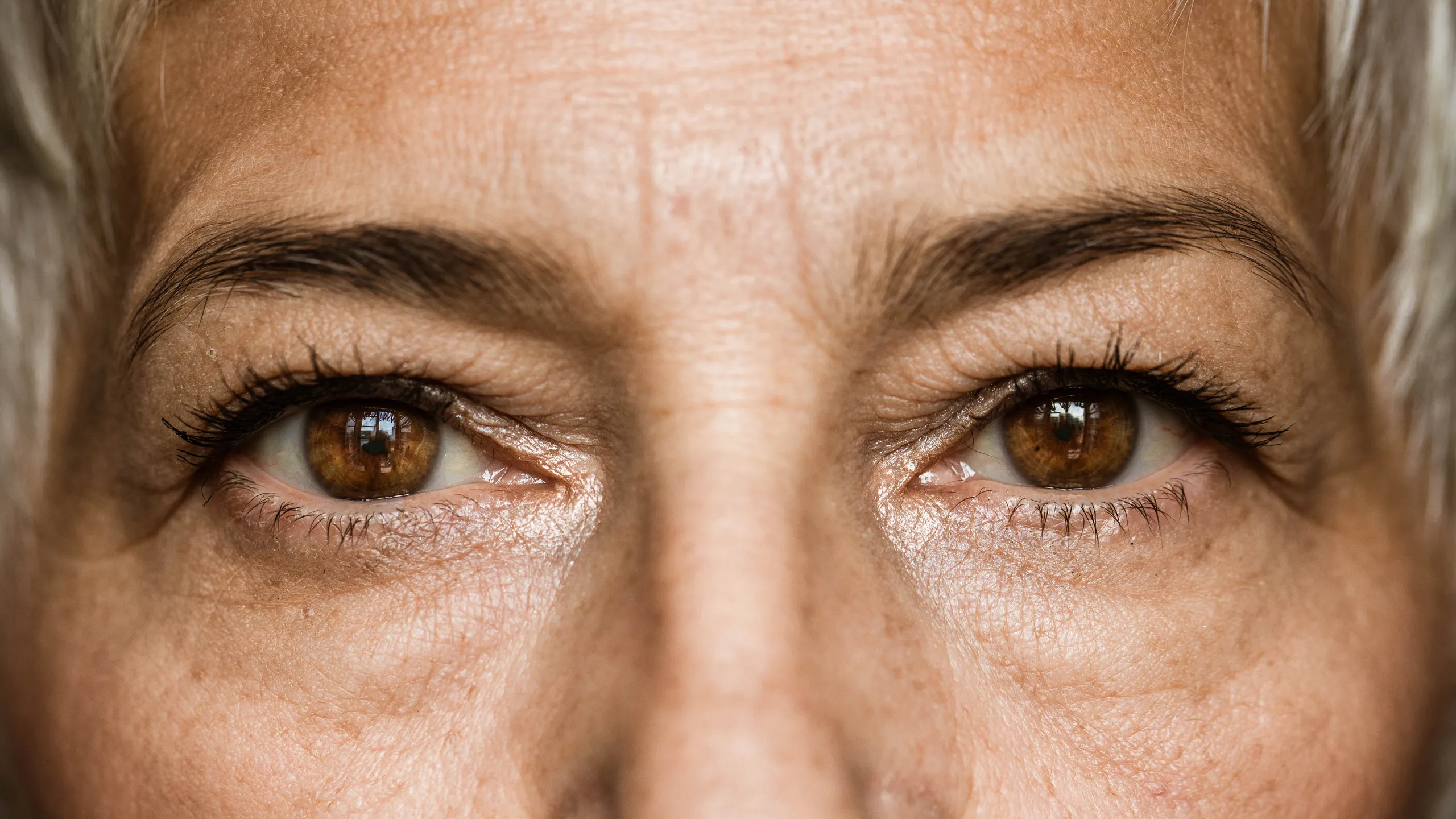 The Truth: Eyeball Collagen Loss as you age!