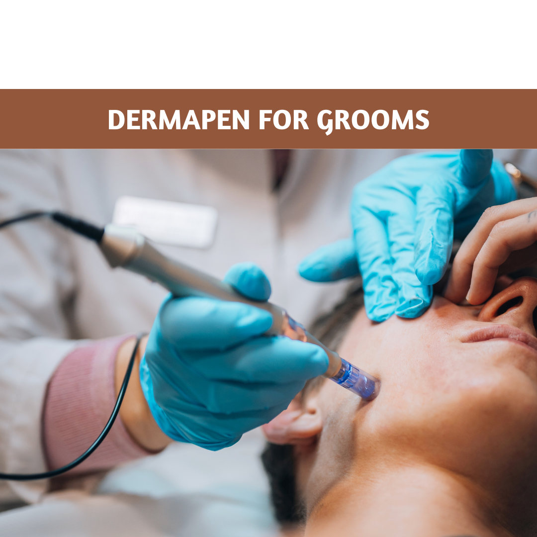 Dermapen: The Ultimate Skin Treatment for Grooms