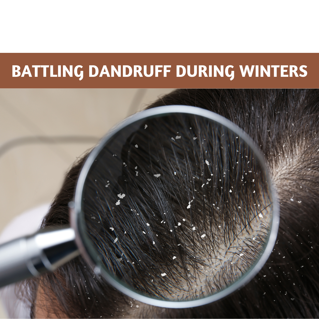 Battling Dandruff in Winter: Your Ultimate Survival Guide