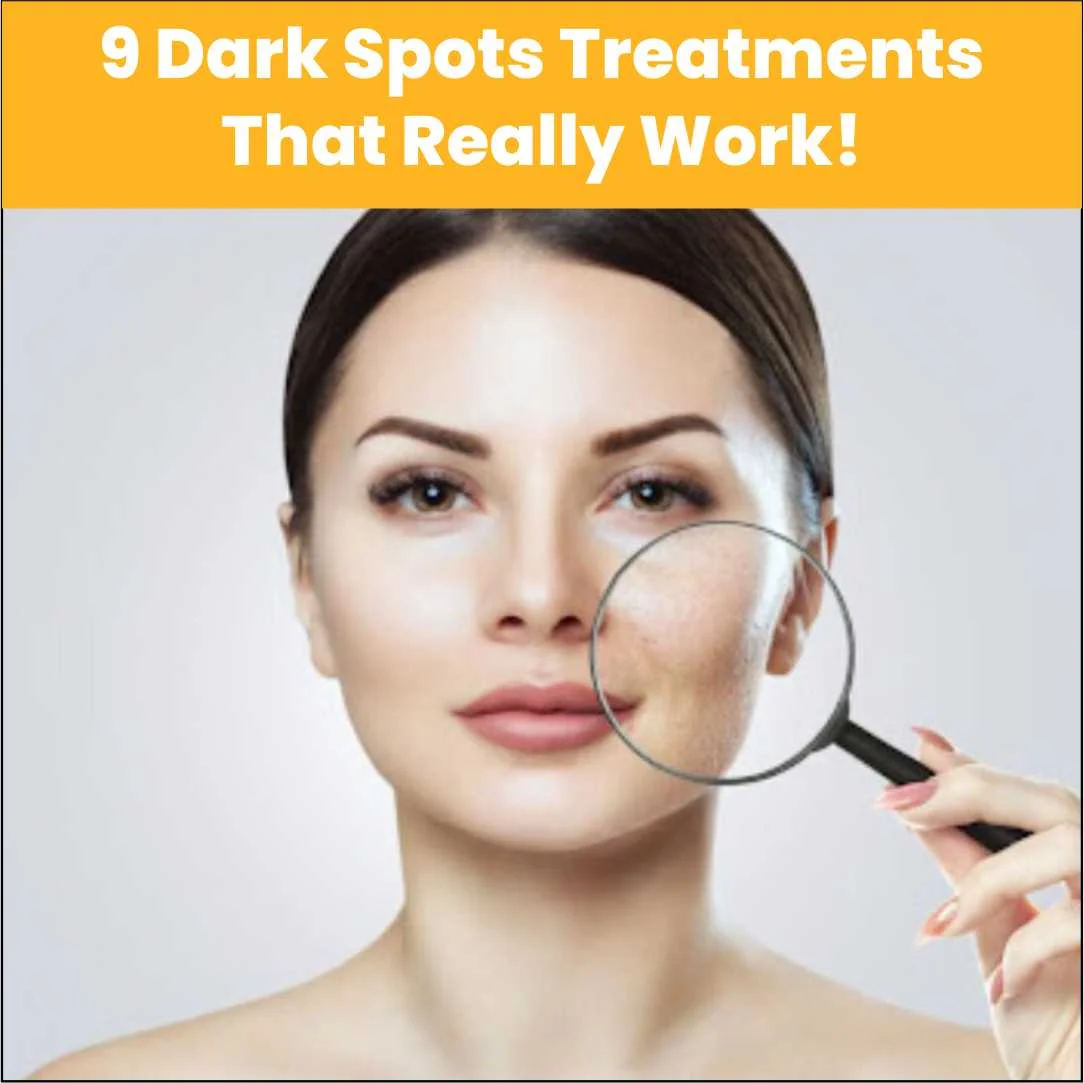 9 Dark Spots Treatments That Really Work! - AAYNA Clinic