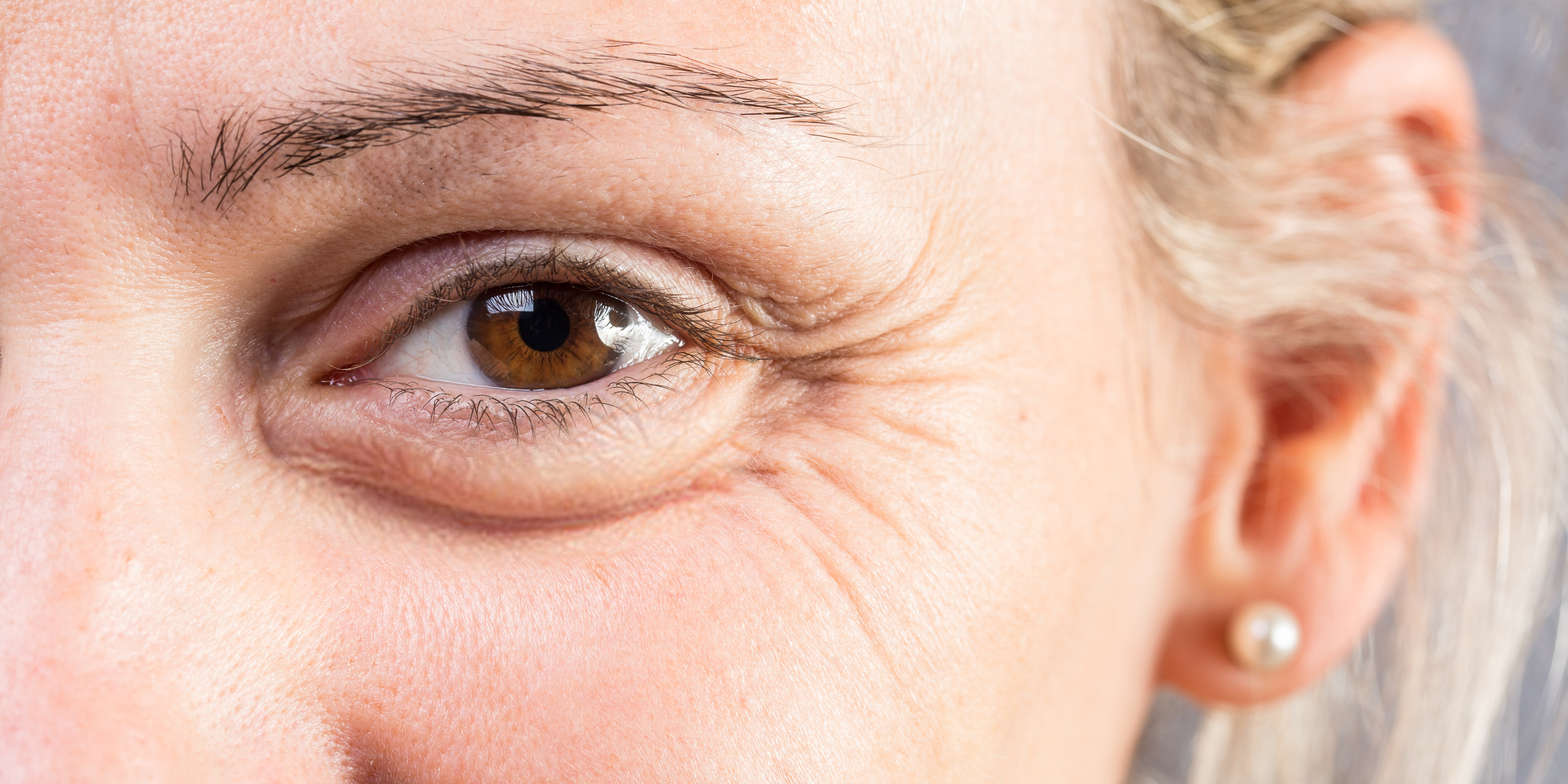 Aayna Renew The Only Anti Aging Treatment You Need