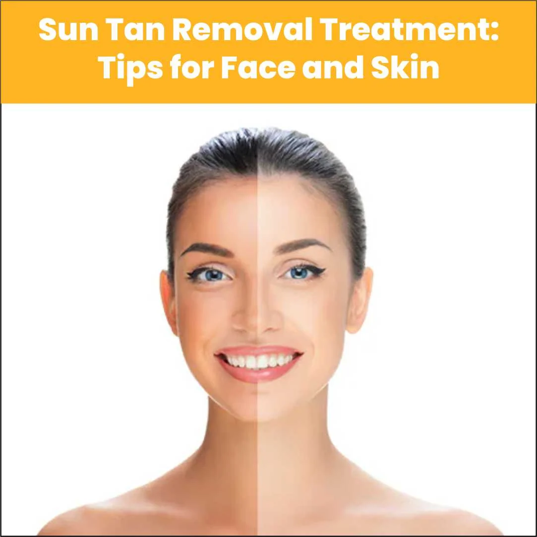 Sun Tan Removal Treatment: Tips for Face and Skin - Aayna Clinic
